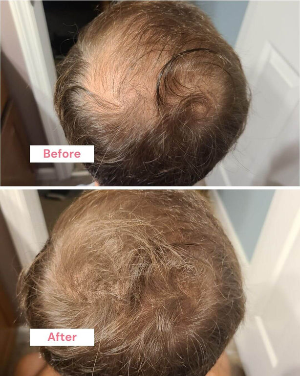 Full Look™ Hair Root Concealer – winksbeaute