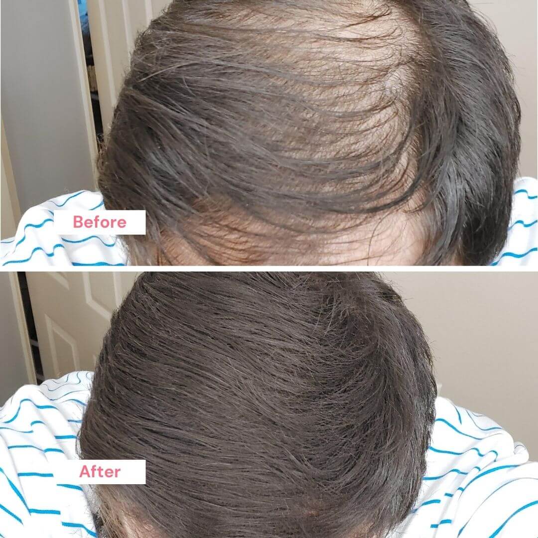 Products – winksbeaute